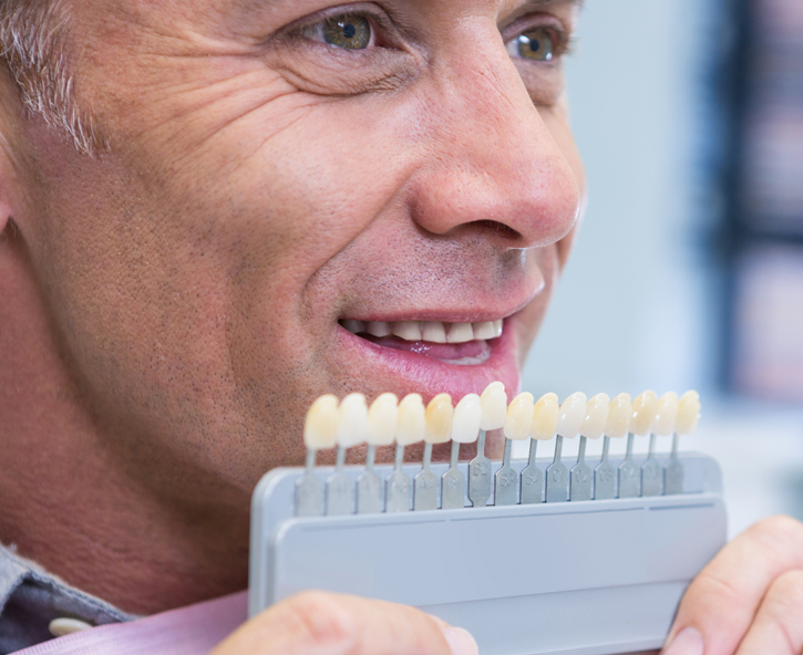 Correct Gummy Smiles & Small Teeth with Porcelain Veneers